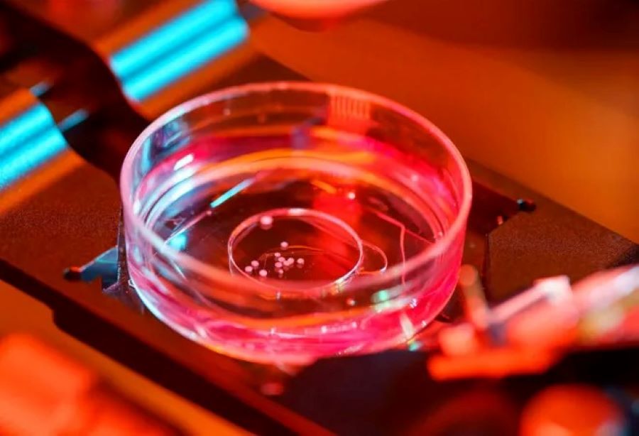 Diving into Organoid Intelligence