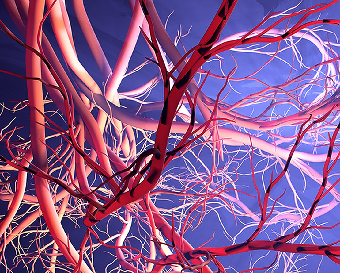 3D micro-ice printing for medical applications